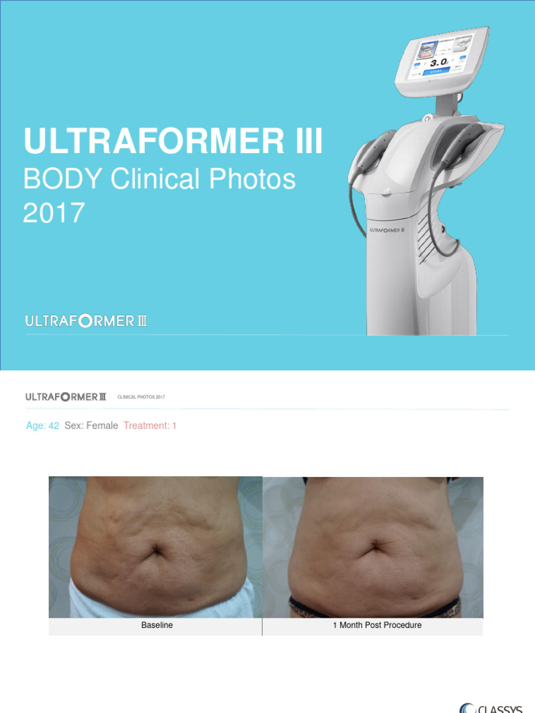 Ultraformer DOC-20230922-WA0014. | PDF