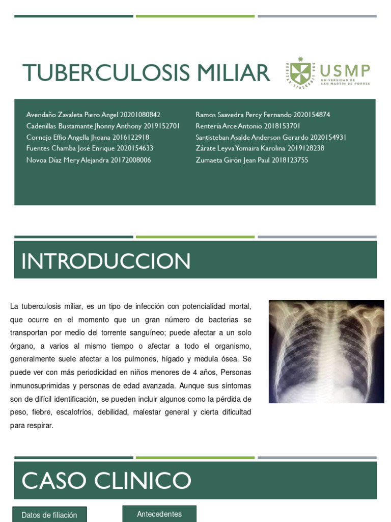 Caso Clínico de Tuberculosis Miliar | PDF