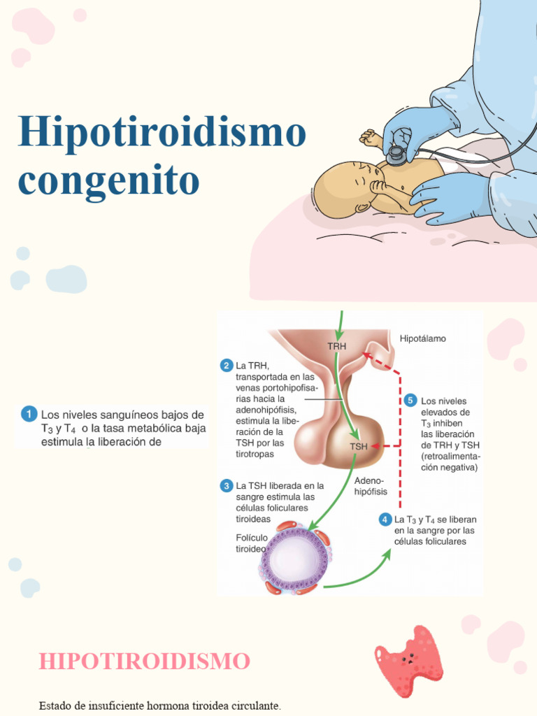 Hipotiroidismo Congenito | PDF