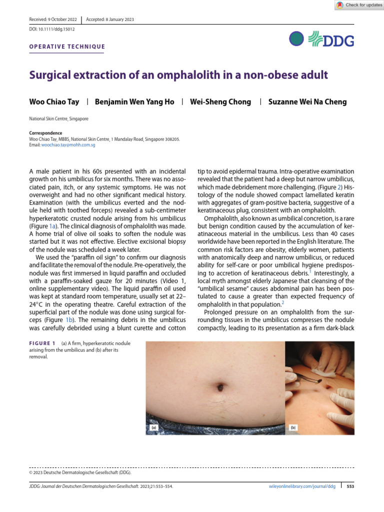 Omphalolith Surgical Extraction | PDF | Surgery | Epidemiology