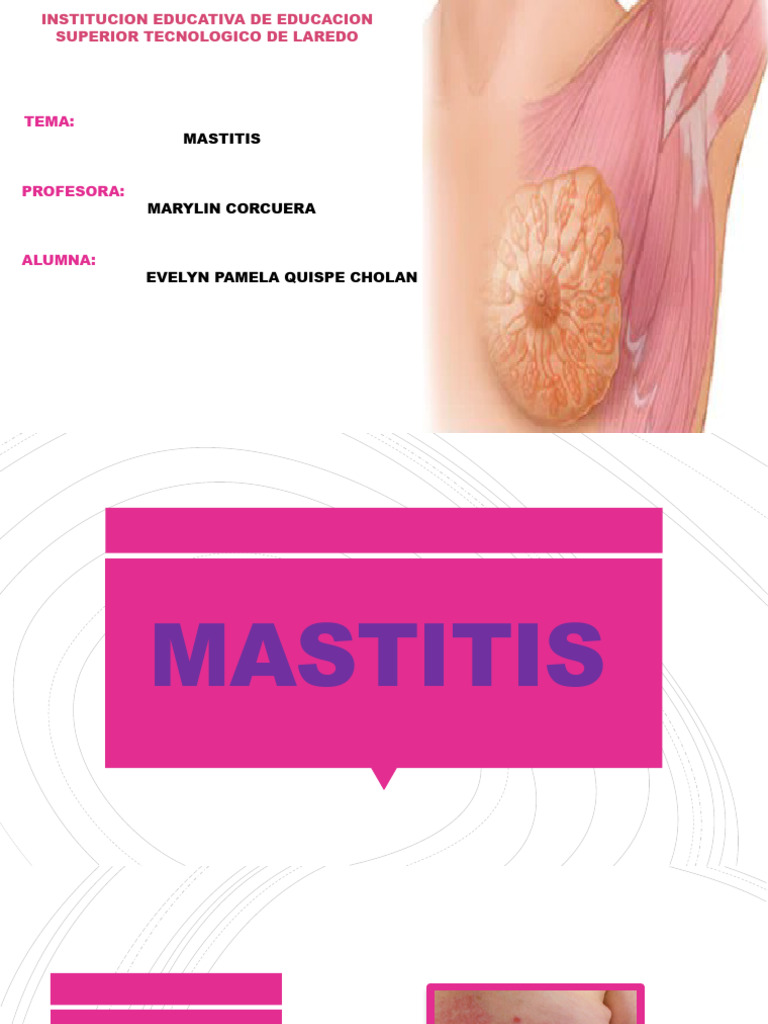MASTITIS | PDF | Pecho | Salud pública