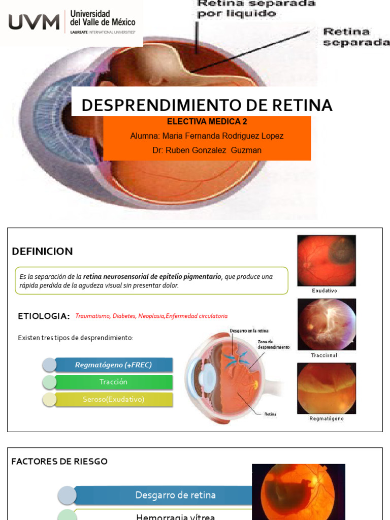 Desprendimiento de Retina | PDF | Diabetes | Oftalmología