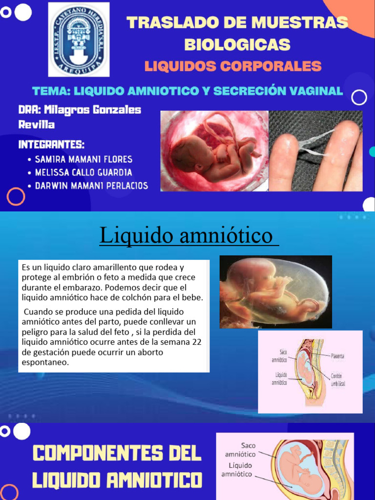 Liquido Amniótico y Secreción Vaginal | PDF | El embarazo | Vagina Liquido Amniótico y Secreción Vaginal | PDF | El embarazo | Vagina