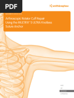 Tornier Flex Shoulder System Operative Technique | PDF | Shoulder ...