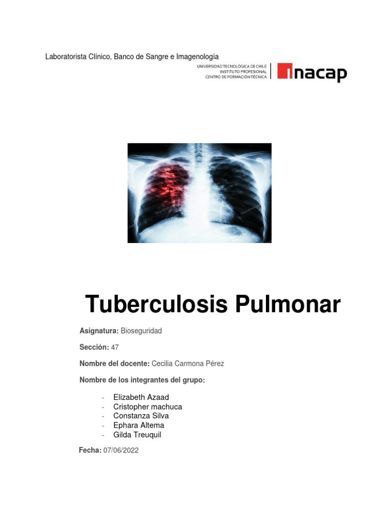 Informe Final Tuberculosis 2022 | PDF
