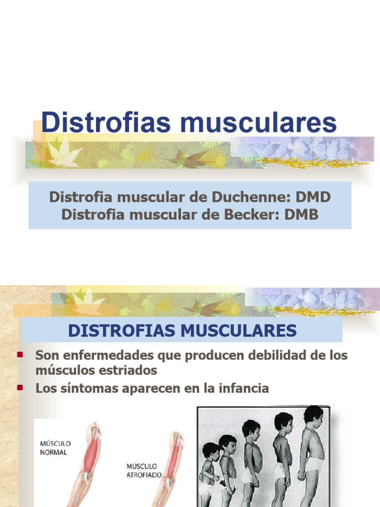 10 Distrofia Muscular de Duchenne y Becker | PDF
