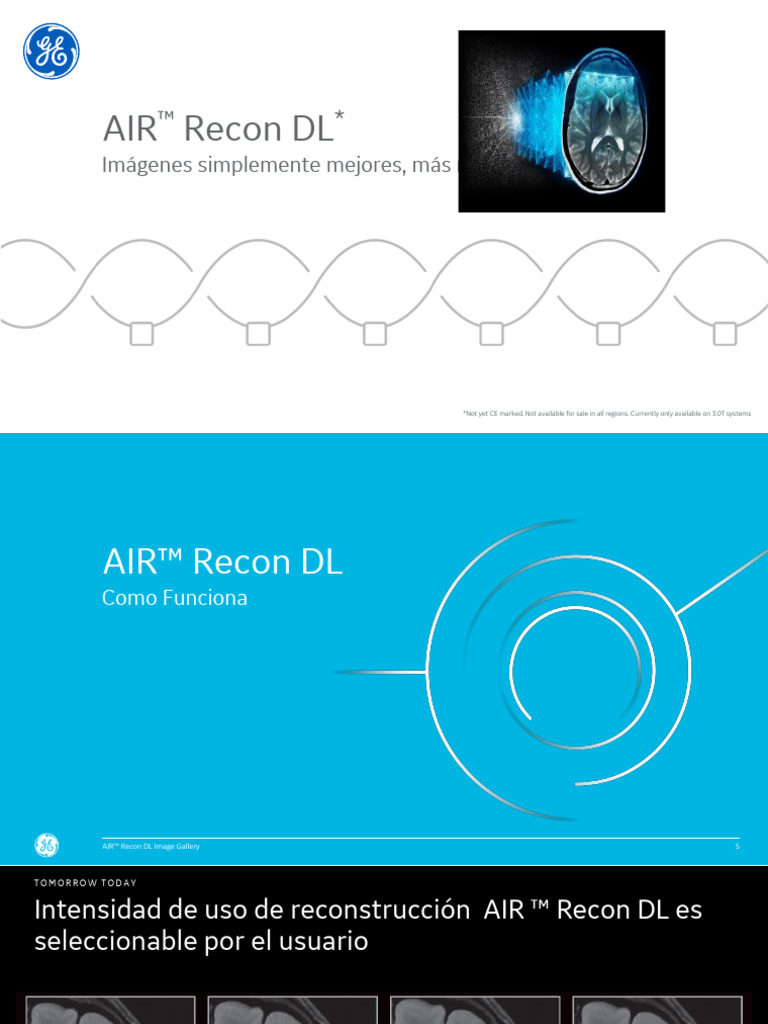 MR - GBL - IG - AIR™ Recon DL - 05132020 - Version Short | PDF