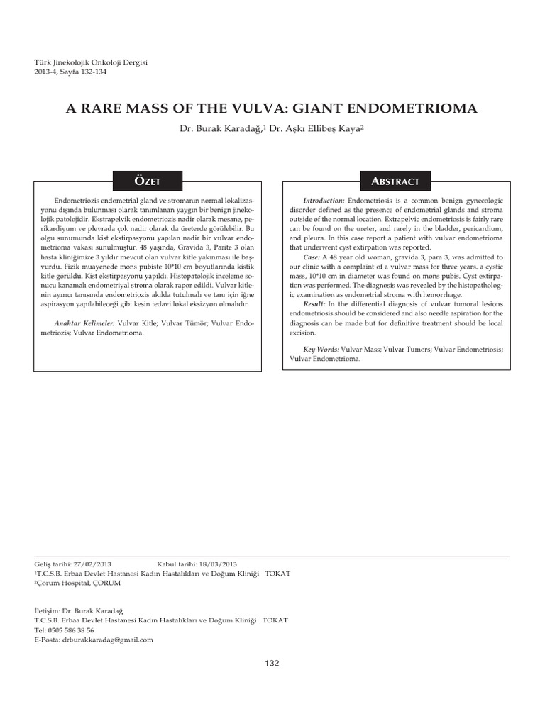 A RARE MASS OF THE VULVA_ GIANT ENDOMETRIOMA[#471675]-555844 | PDF