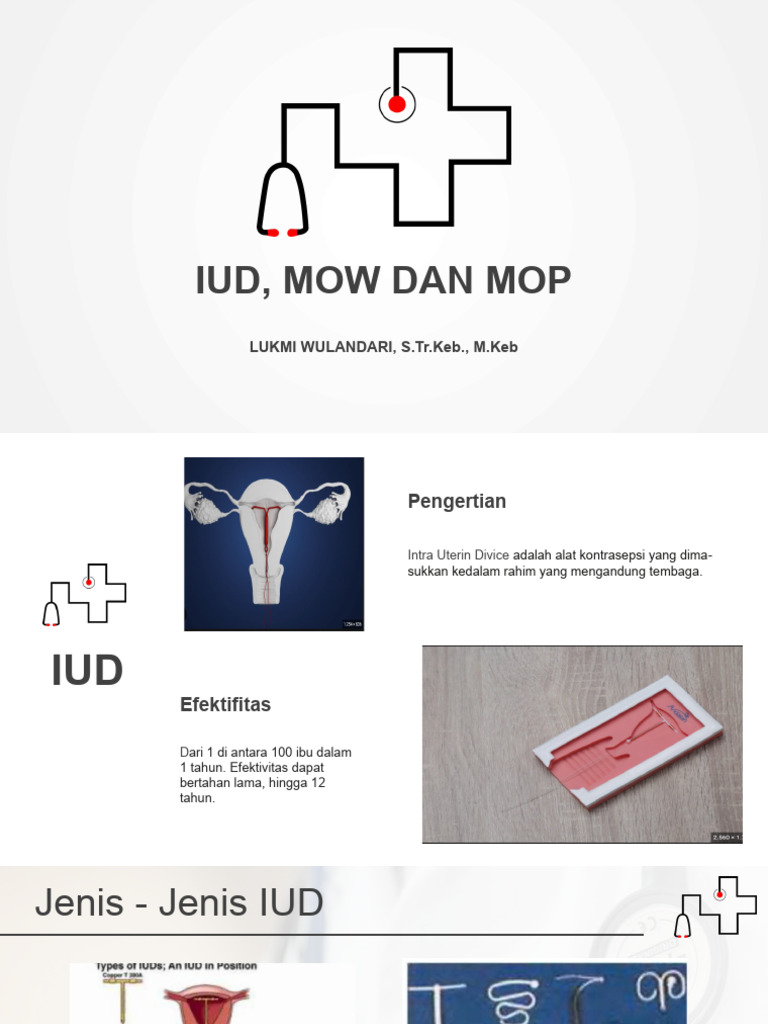 Iud, Mow, Mop | PDF