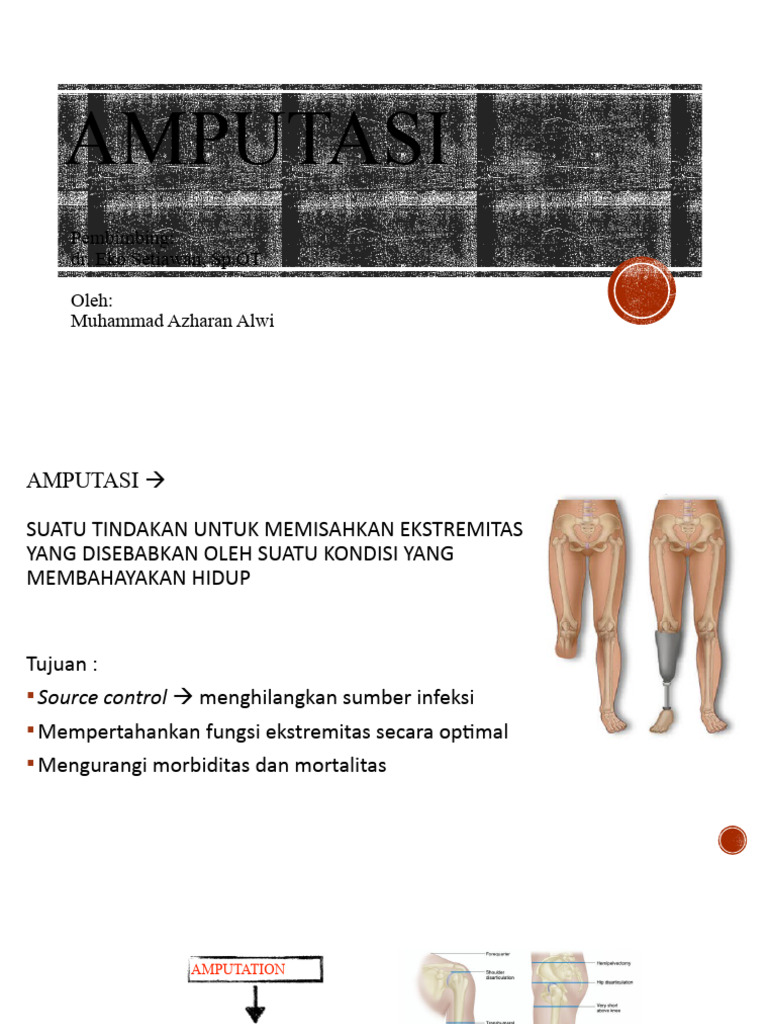 Amputasi 0 | PDF
