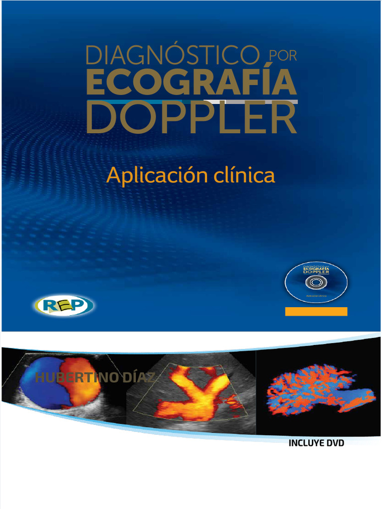 Dokumen - Tips Diagnostico Por Ecografia Doppler 1pdf | PDF