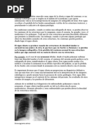 Signos Radiológicos Neumoperitoneo | PDF