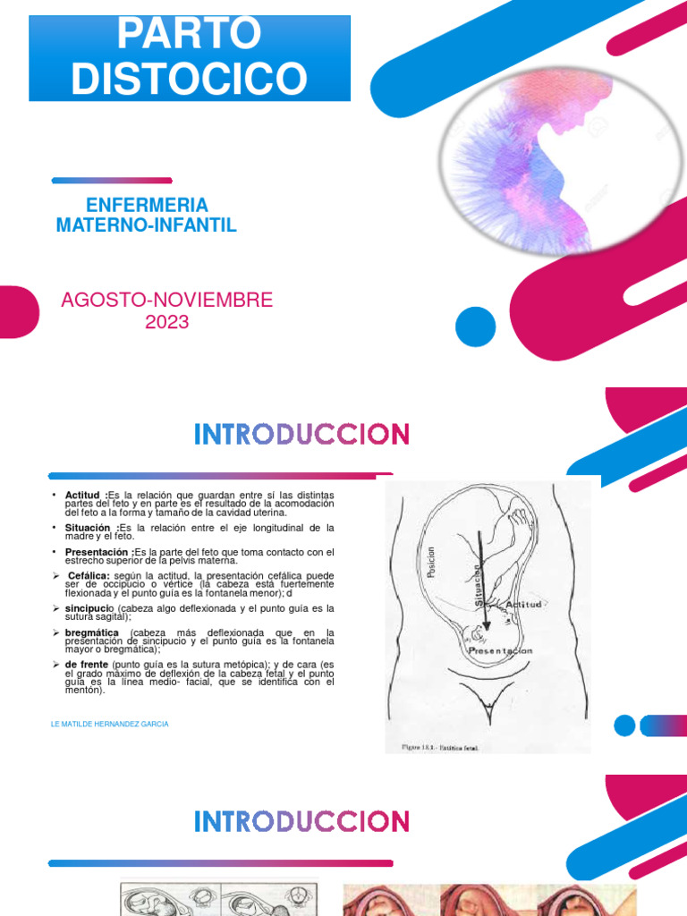 Parto Distocico | PDF