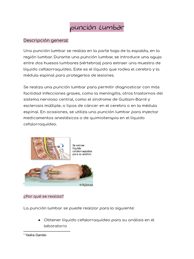 Punción Lumbar | PDF | Especialidades Medicas | Medicina
