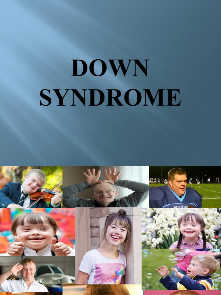 Down Syndrome | PDF | Down Syndrome | Genetic Disorder