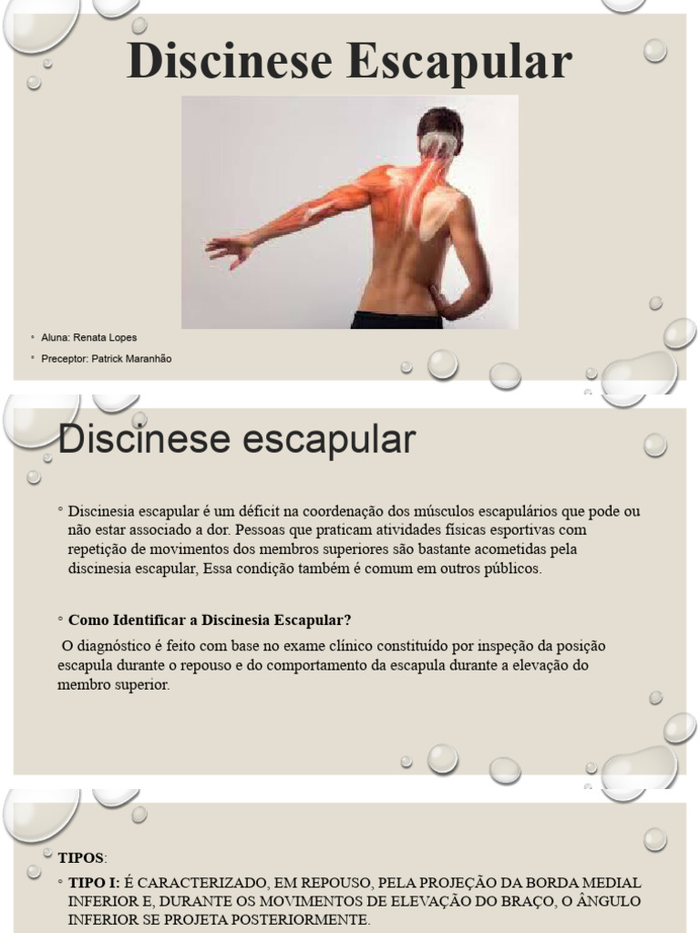 Discinesia Escapular | PDF