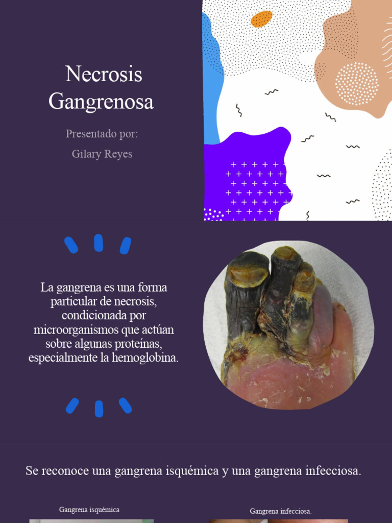 Necrosis Gangrenosa | PDF