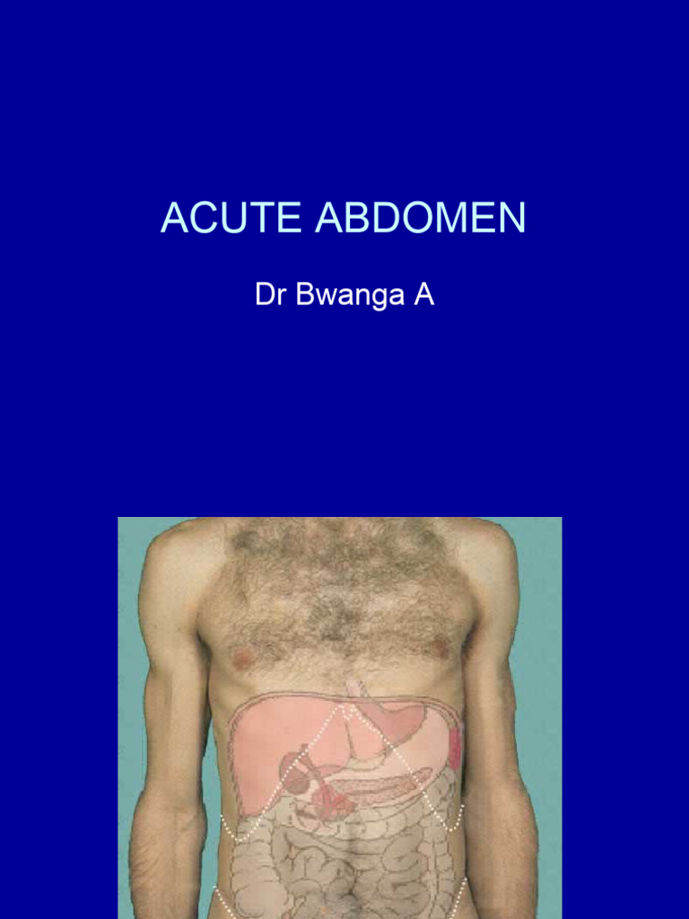 1. Acute Abdomen | PDF