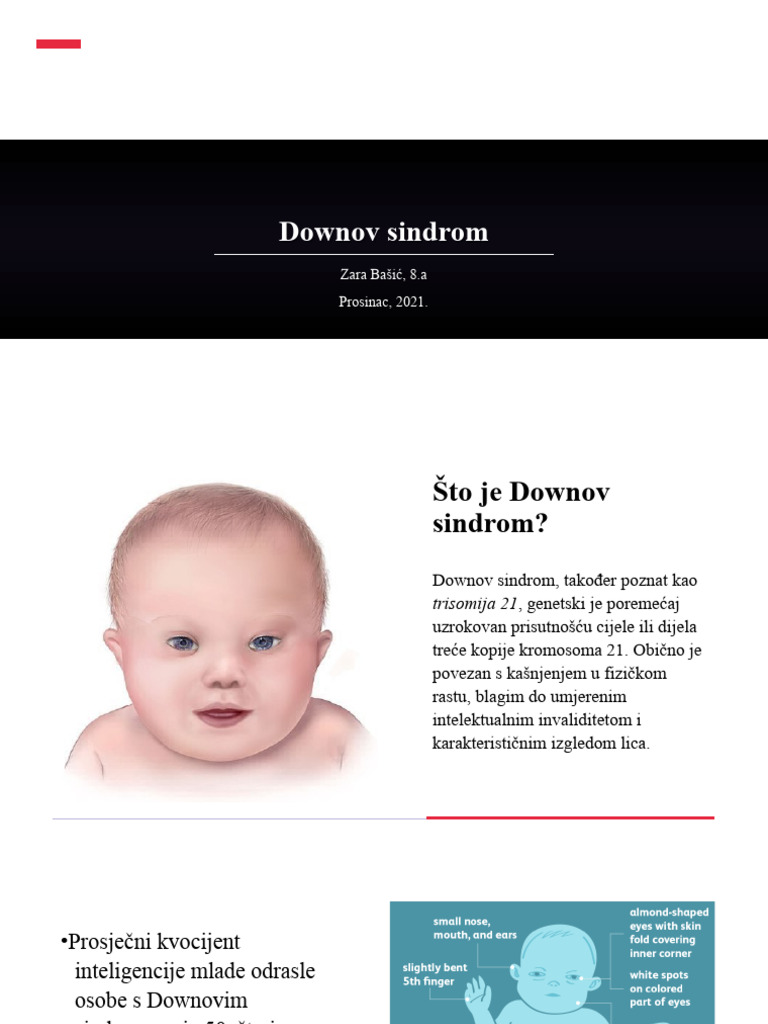 Down Sindrom - Zara Bašić - BIO - Prosinac, 2021 | PDF