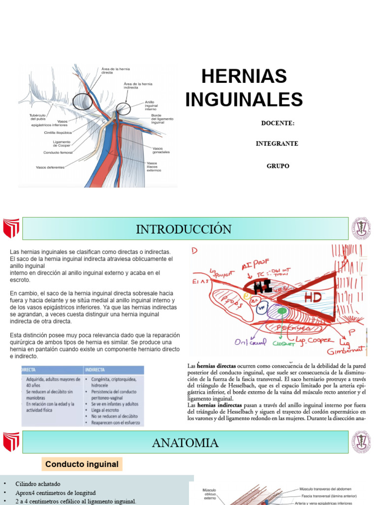 HERNIAS | PDF