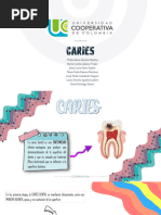 Etapas y Grados de Caries PDF | PDF | Diente | Odontología