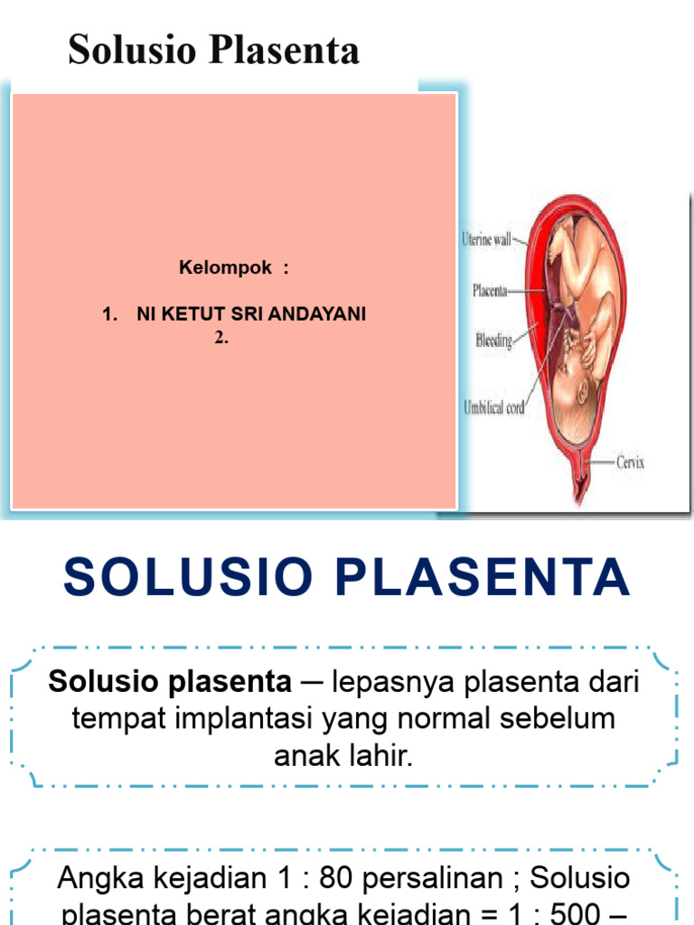 PPT solusio-plasenta | PDF