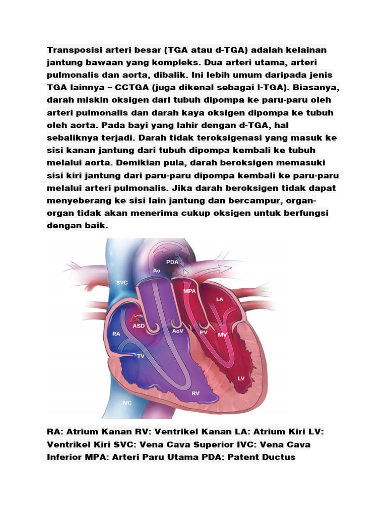 Transposisi Arteri Besar Translate | PDF