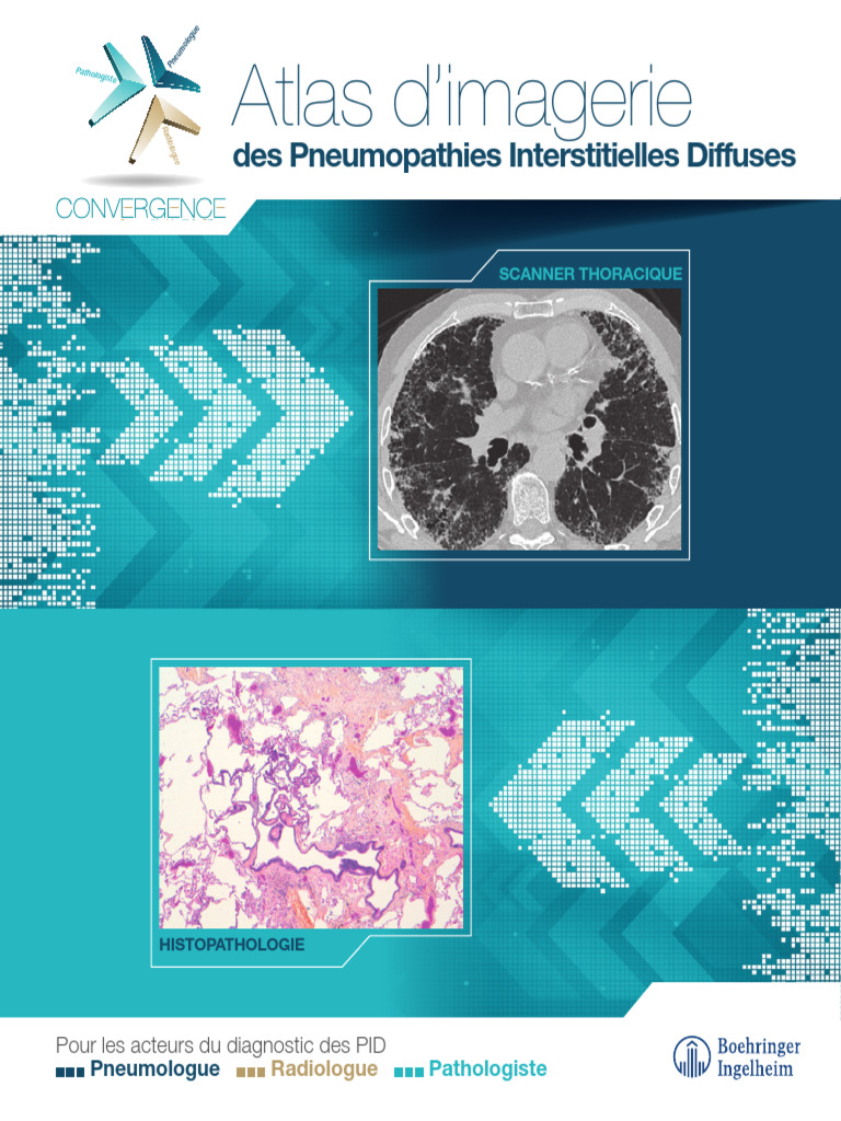 2019 - Atlas D'imagerie Des PID | PDF