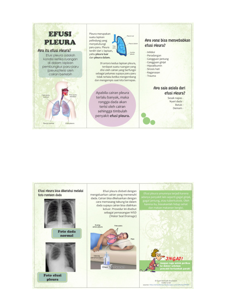 Efusi Pleura - Paru | PDF