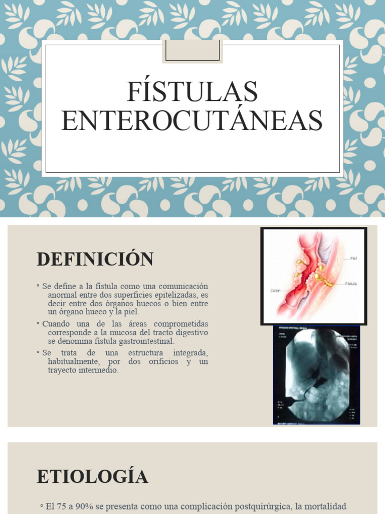 Manejo de Fístulas Enterocutáneas | PDF | Salud y bienestar