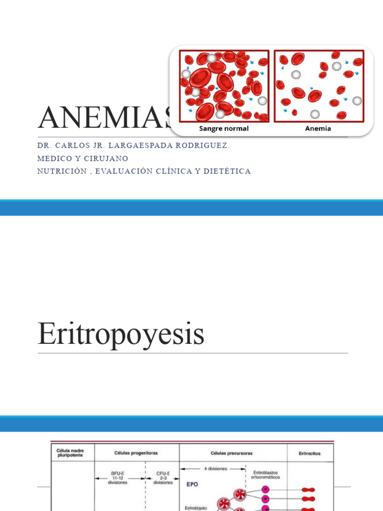 Anemia S | PDF