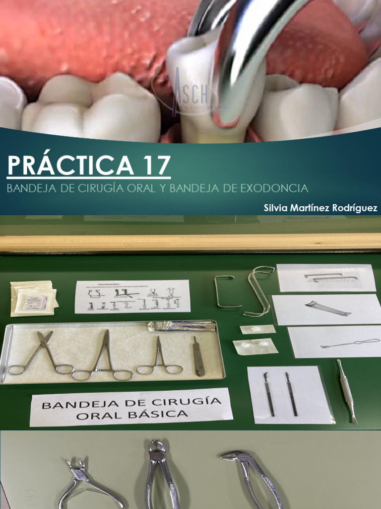 PRÁCTICA 17 Toe | PDF