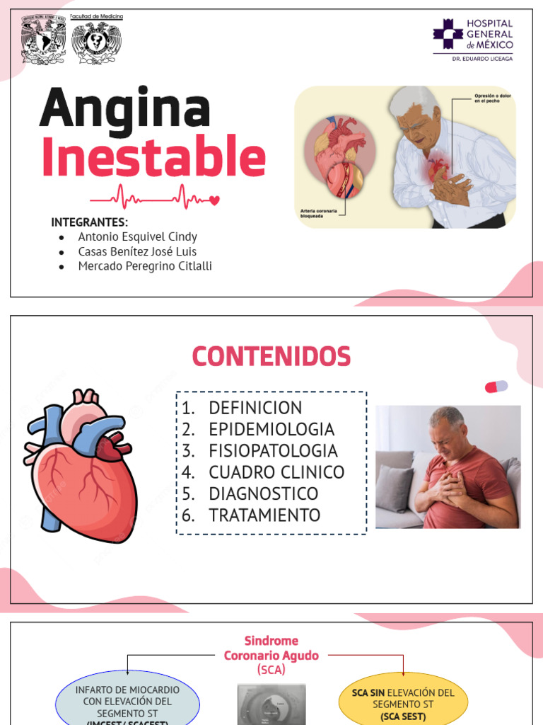 Angina Inestable | PDF | Infarto de miocardio | Isquemia