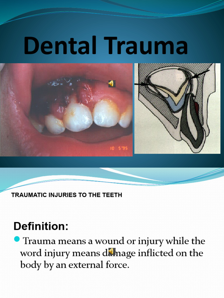 Dental Trauma | PDF