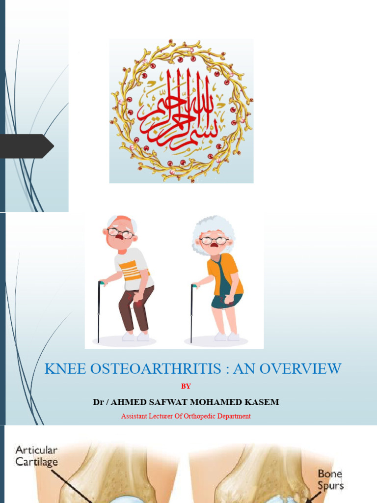 Osteoarthritis 191016103144 Pdf Osteoarthritis Knee