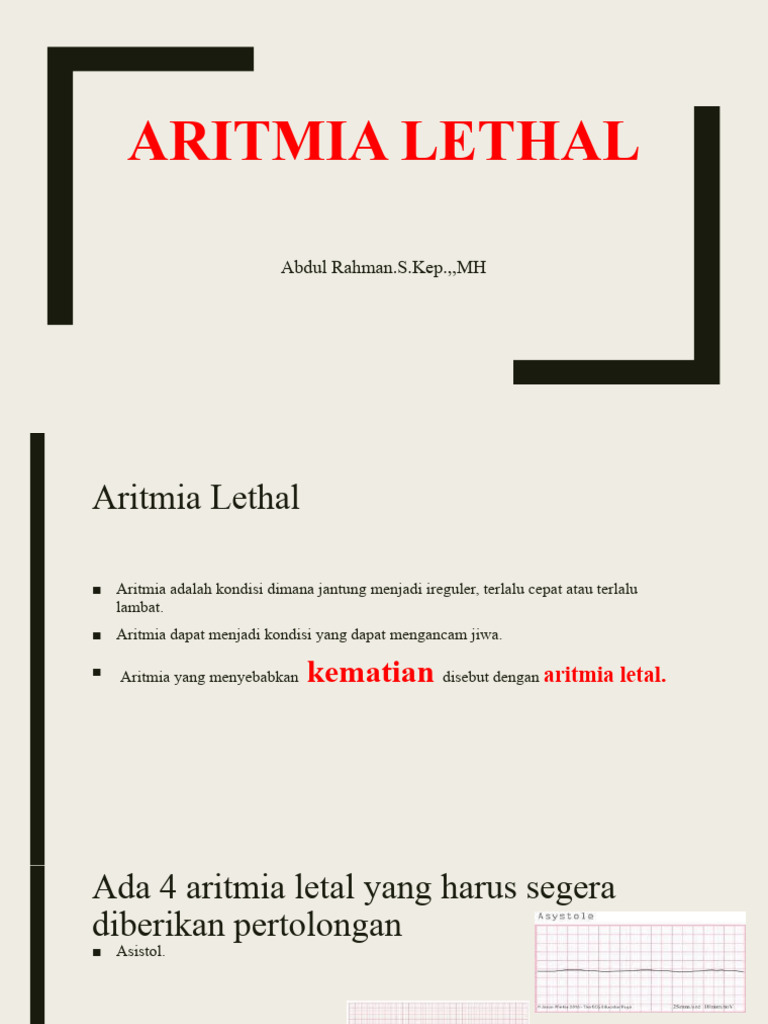 Aritmia Lethal | PDF