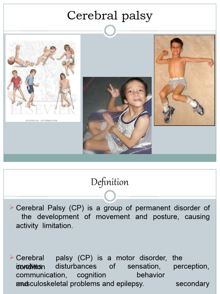 2 Cerebral Palsy | PDF