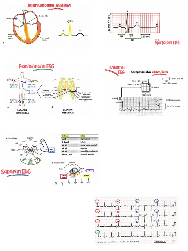 Cara Baca EKG 1 | PDF