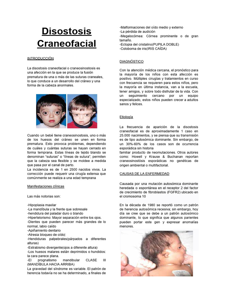 Disostosis Craneofacial | PDF | Ortodoncia | Odontología