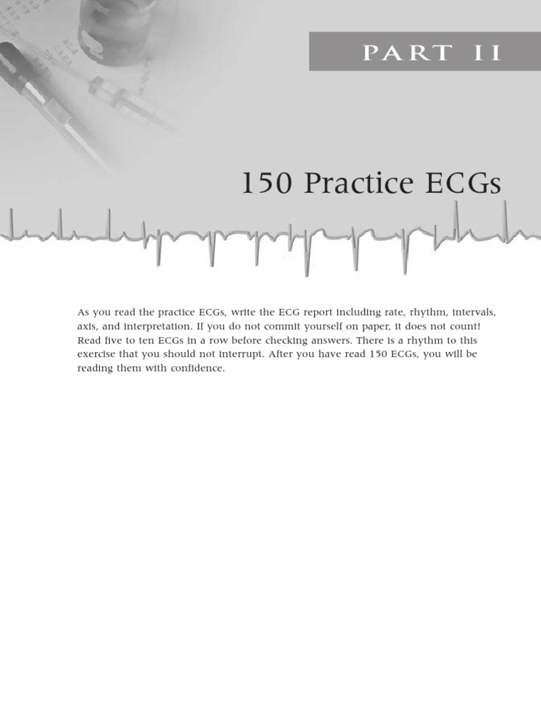 150 Practice Ecgs | PDF | Electrocardiography | Heart Failure