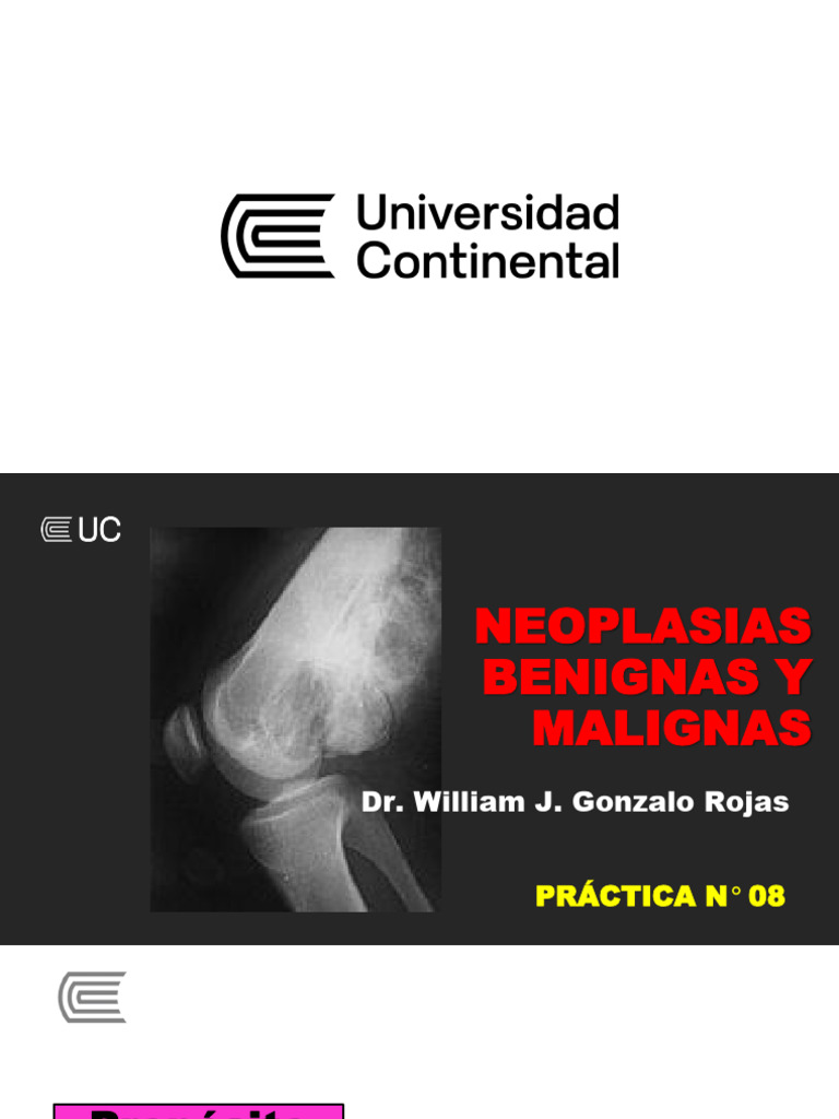 Neoplasias Benignas y Malignas: Casos Clínicos | PDF | Ciencia y ...