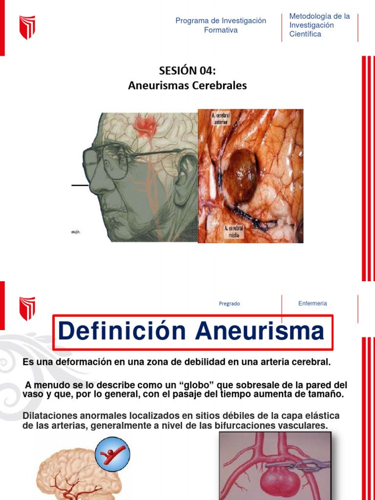 Aneurismas Cerebrales | PDF | Carrera | Fisiología