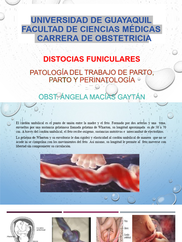 Distocia Funicular | PDF