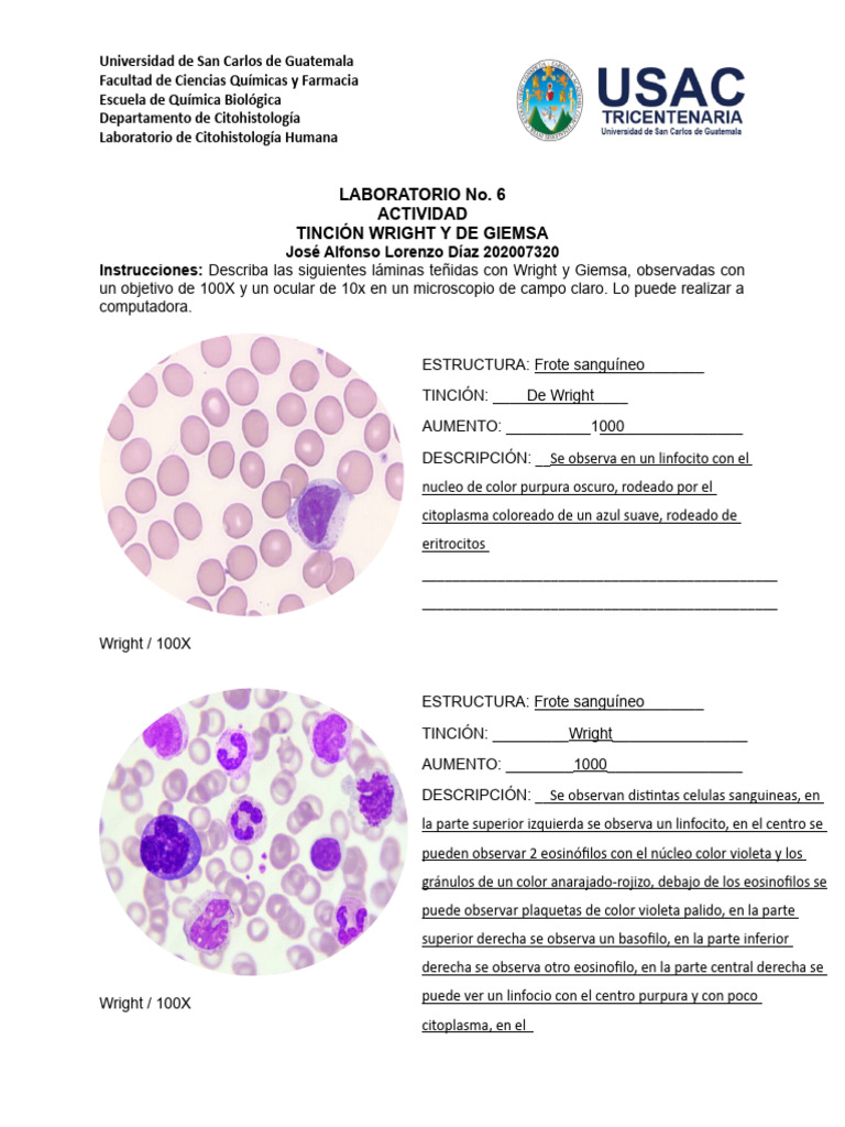 ACTIVIDAD Laboratorio 6, Tinción de Wright y Giemsa | PDF