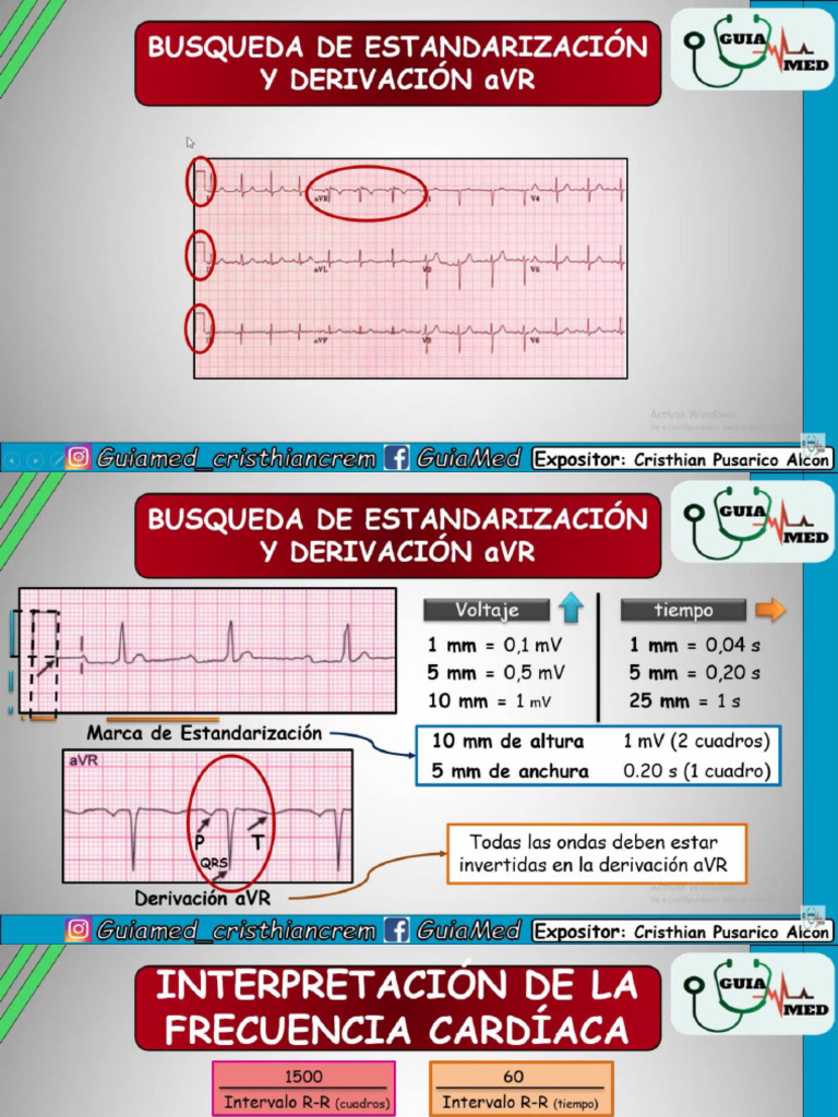 Interpretacion de Ekg | PDF