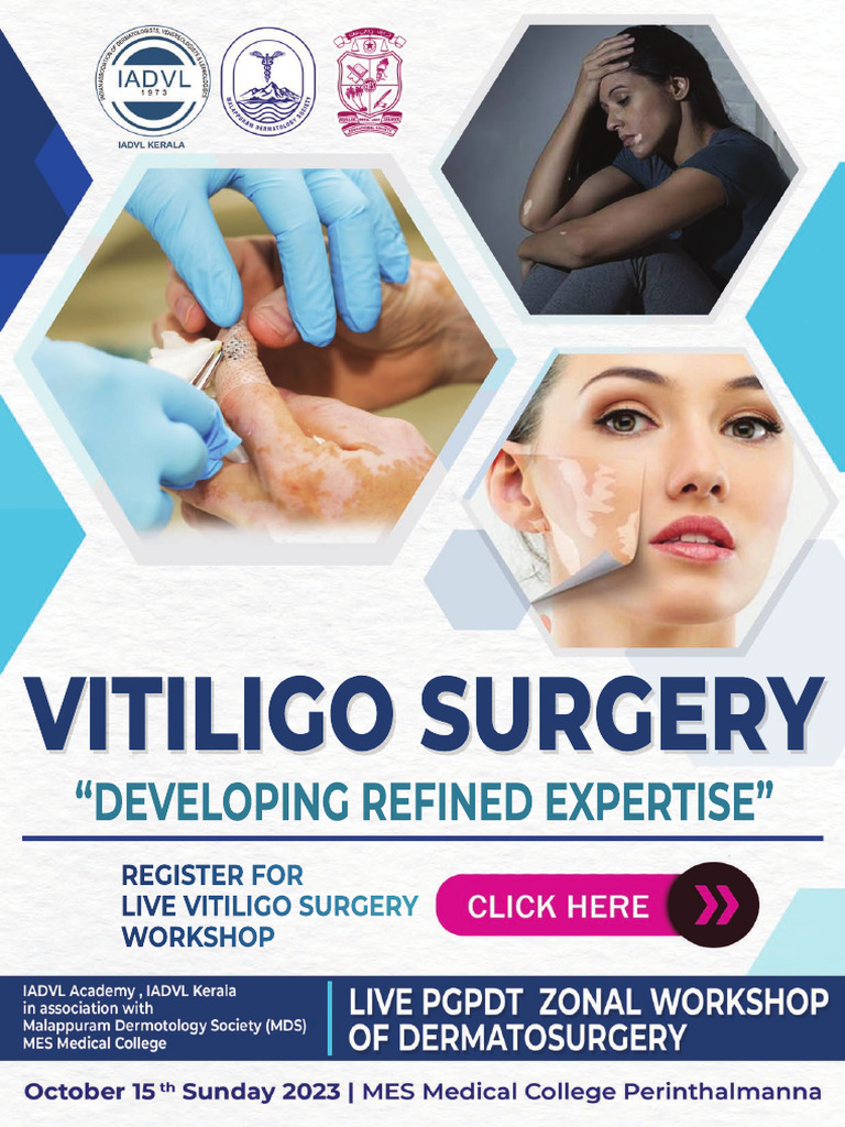 PGPDT Vitiligo Surgery 15 - 10 - 2023 | PDF