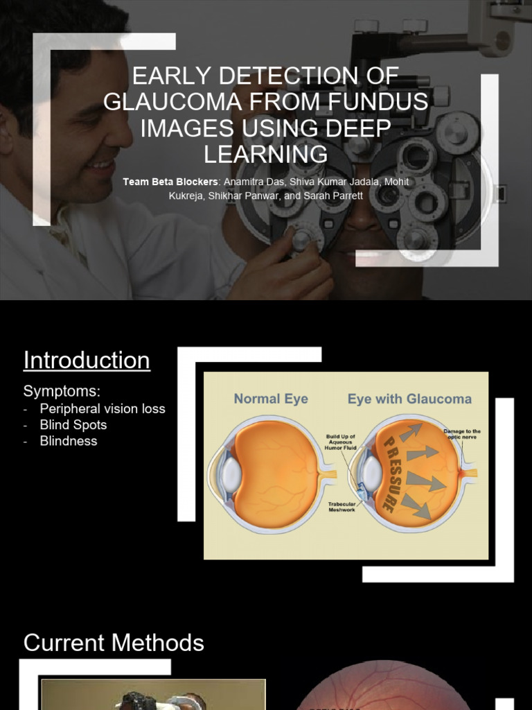 Deep Learning for Glaucoma Detection | PDF
