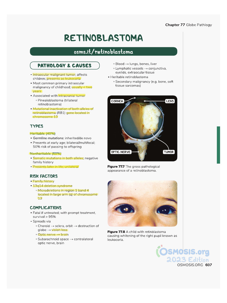 Retinoblastoma | PDF