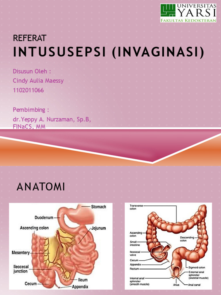 Referat-Intususepsi | PDF