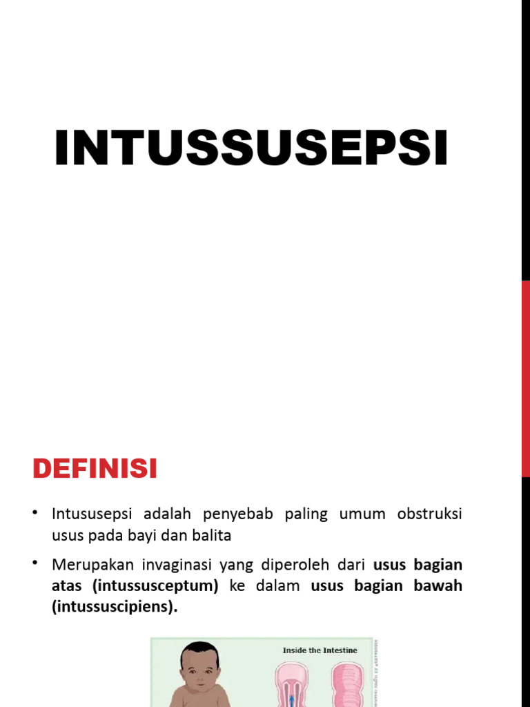 Intussusepsi | PDF